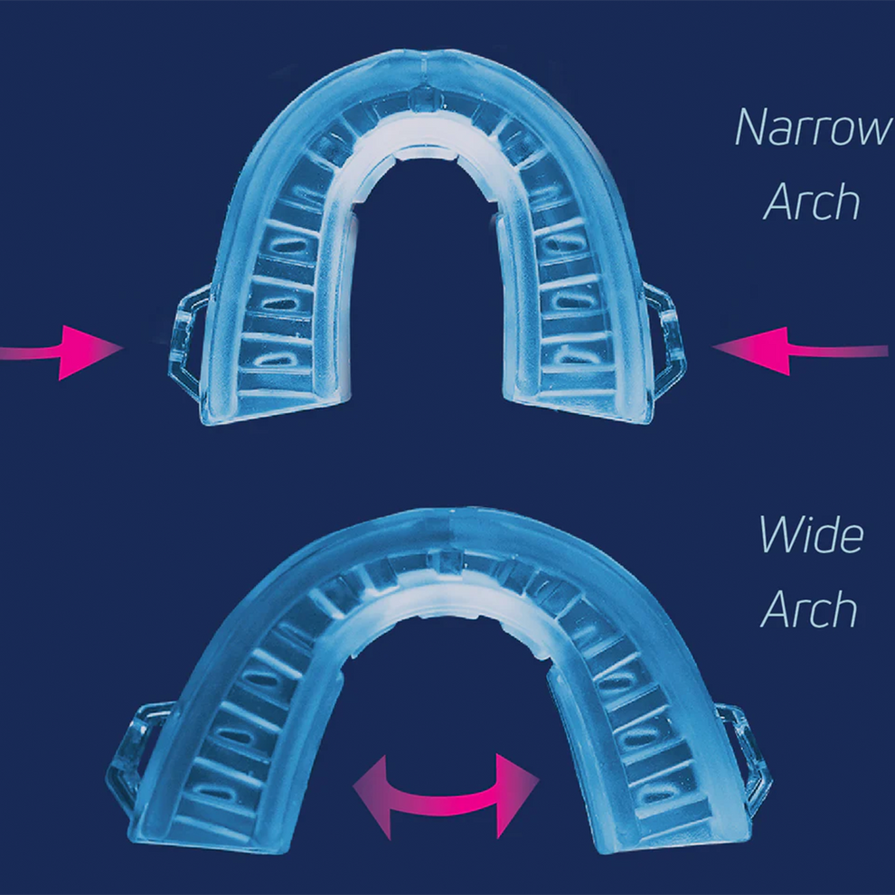 SmartGuard Anti-Snore Device
