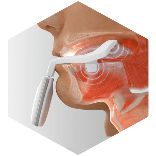 exciteOSA Tongue Stimulator for Sleep Apnea