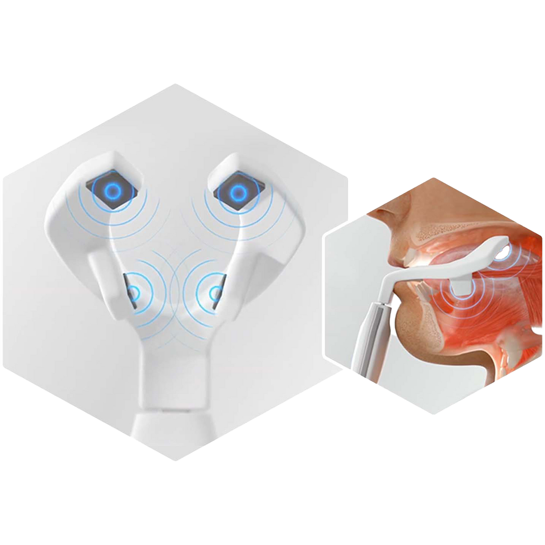 exciteOSA Tongue Stimulator for Sleep Apnea